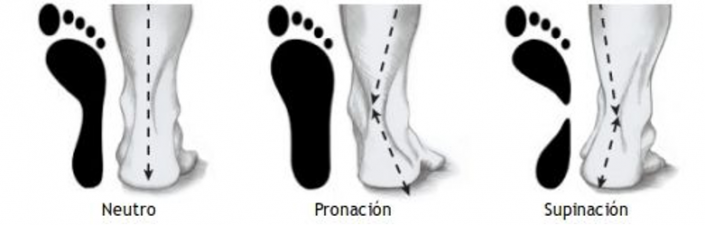 TALALGIA, ¿FASCIOPATÍA, FASCITIS PLANTAR, ESPOLÓN? – InMuv Sevilla ...